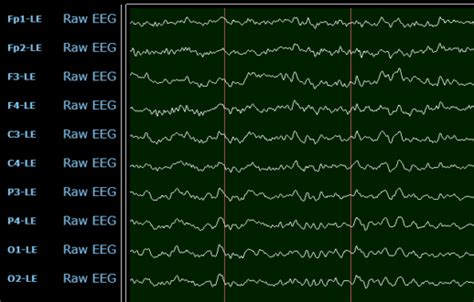 Brain Mapping Services ThinkOne