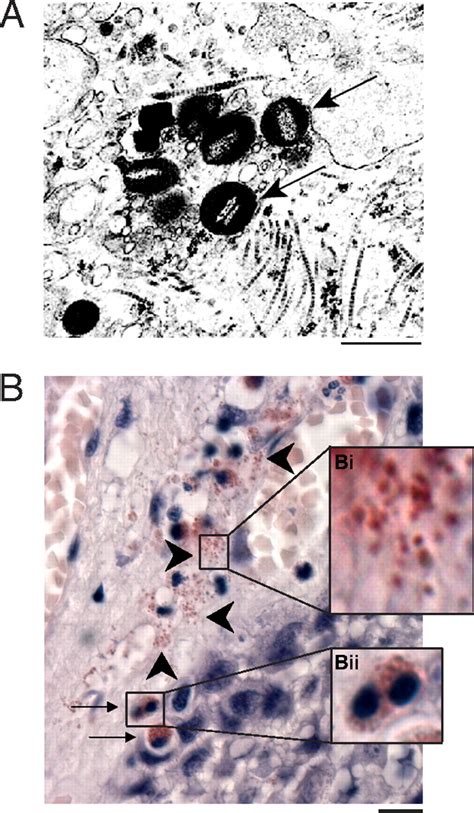 Eosinophil Granules Function Extracellularly As Receptor Mediated