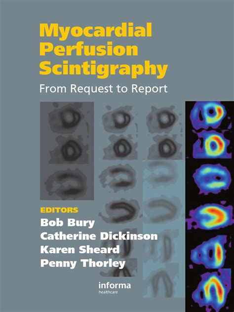 Myocardial Perfusion Nuclear Medicine Medical Imaging Free 30 Day Trial Scribd