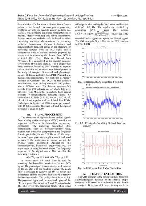 Identification Of Myocardial Infarction From Multi Lead Ecg Signal Pdf