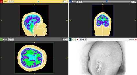 ccny uses simpleware 3d image processing software to create models for