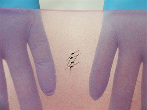 Suture Patch Large The Science Bank