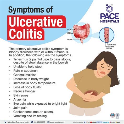 Dhea And Ulcerative Colitis At George Buttenshaw Blog