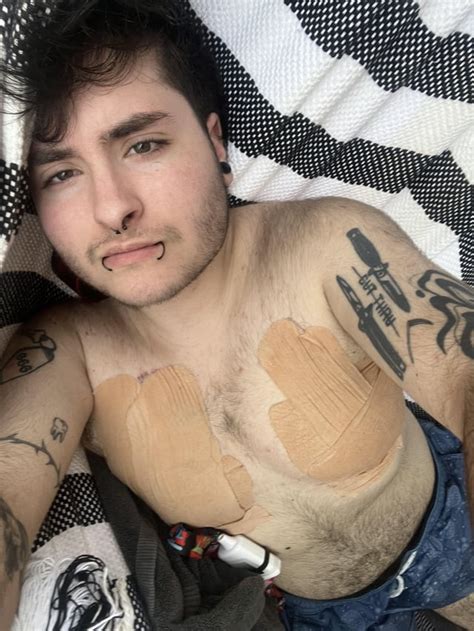 Trans Tape Is A Life Saver Even Guys Like Me With Bigger Chests R