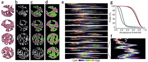 Histology Model And Automated Classification A Four