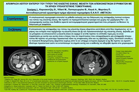 Closed Loop Obstruction Ppt