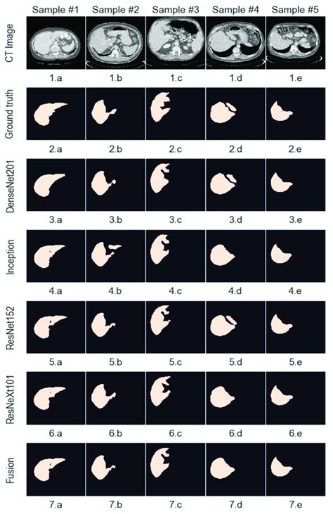 Sample Liver Segmentations Download Scientific Diagram