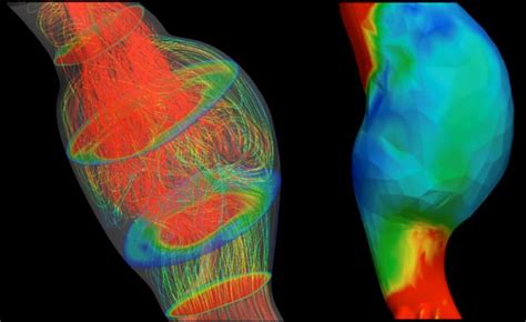 Applied Radiology On Linkedin Image Based Computational Model Predicts