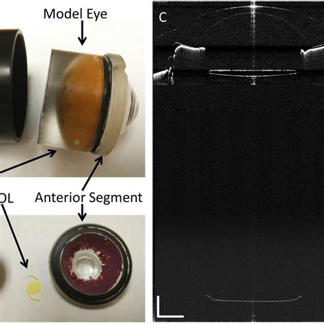 A Model Eye With An Iol Used For Calibration A Model Eye Upper Left Download Scientific