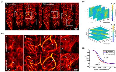 In Vivo Aberration Correction Through Intact Skull And Skin In A