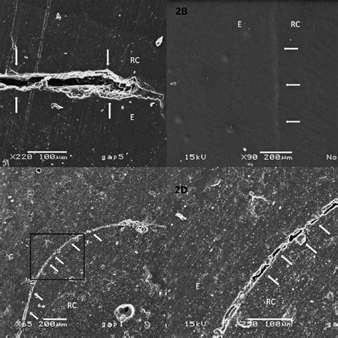 Pdf Selective Enamel Etching Effect On Marginal Adaptation Of Self