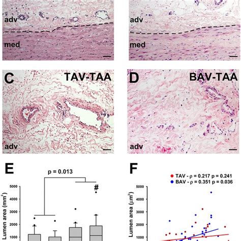 Chronic Inflammation In The Ascending Aortic Adventitia Of Aneurysmal Download Scientific