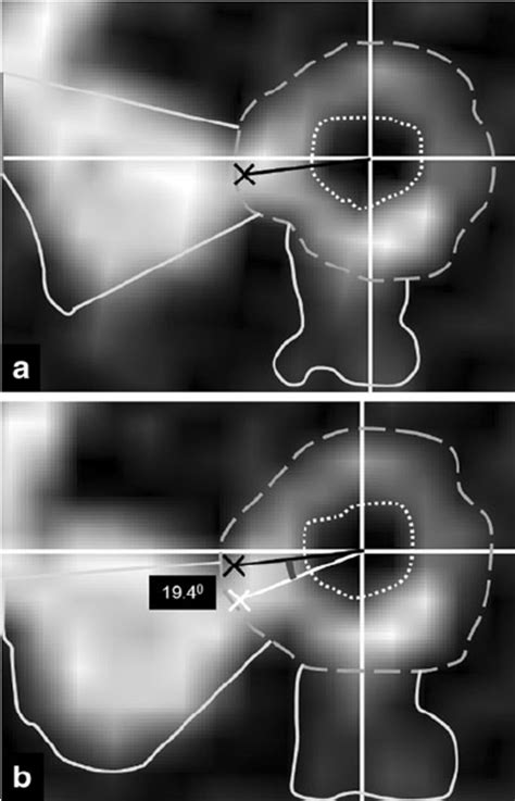 Calculation Of Registration Offsets Images Showing The Inner Dotted