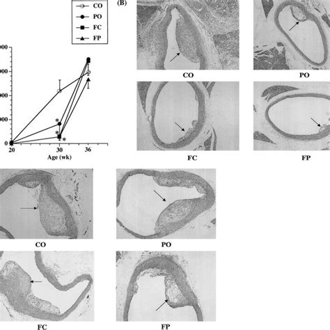 Lesion Progression In Apolipoprotein E Apoe Knockout Ko Mice Fed Download Scientific