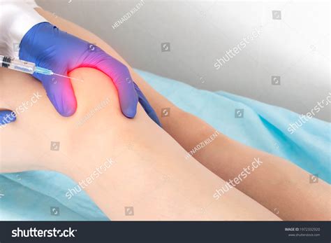 Intra Articular Block Photos And Images And Pictures Shutterstock