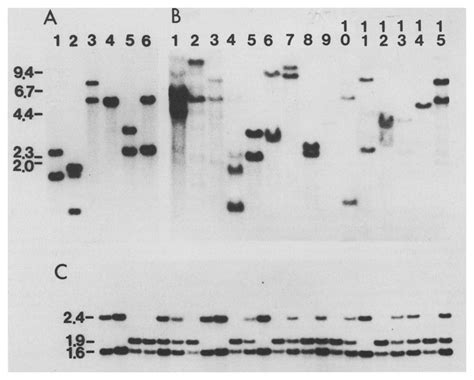 Southern Blot Analysis A Survey Of Restriction Fragment Length