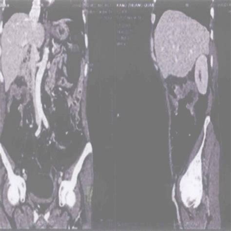 Scanned Image Of Ct Reconstruction Image After Enhancement Download Scientific Diagram