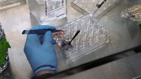 Video Migration Assay Of Murine Adipose Derived Mesenchymal Stromal Cells