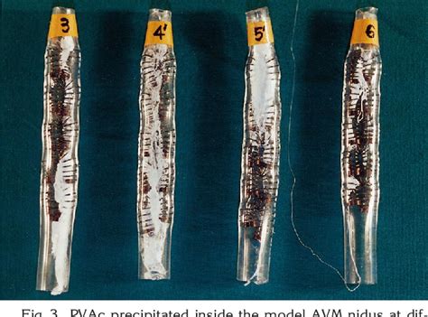 Figure 1 From An Arteriovenous Malformation Model For Testing Liquid Embolic Materials