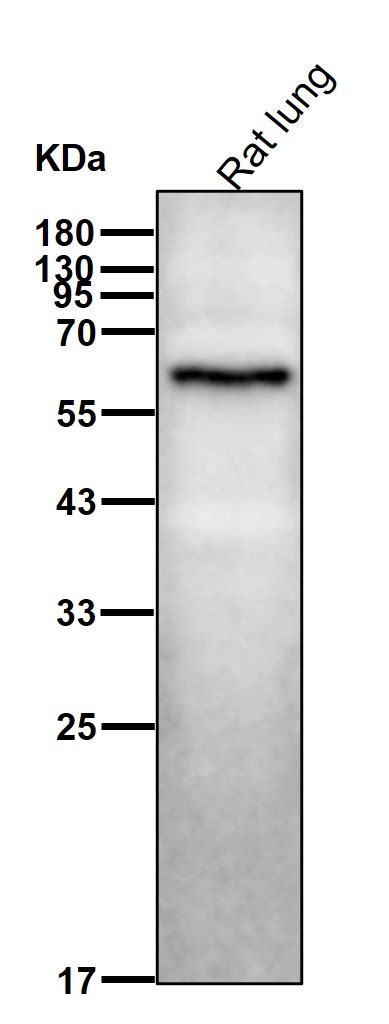 Rabbit Monoclonal To Klc1klc1 远泰生物抗体定制