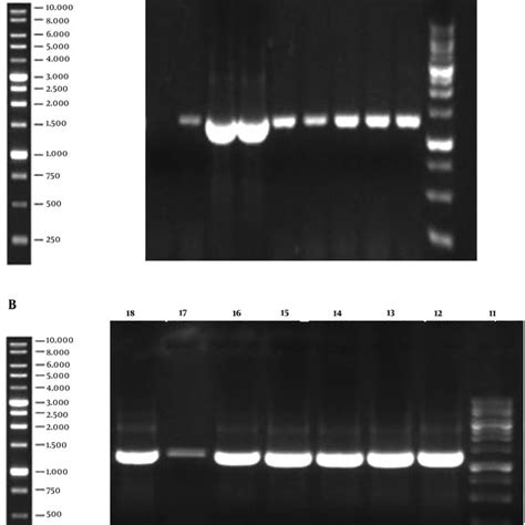 Pdf Expression Purification And Verification Of Recombinant Botulinum Neurotoxin Type A