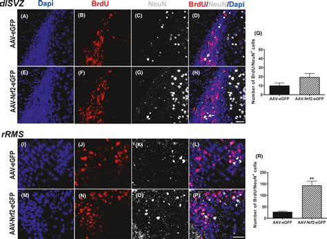 Effects Of NRF Overexpression On Neuronal Maturation Of The NSPCs Download Scientific Diagram