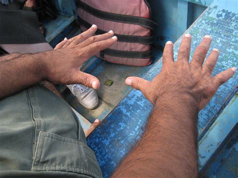 File6 Finger Wikimedia Commons