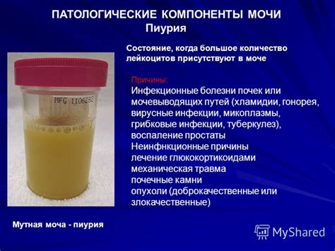 Презентация на тему: "Биохимия почек и мочи, мочеобразование. ПЛАН ...