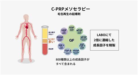C Prp注入治療｜ゴリラクリニックのaga・薄毛治療