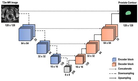 U Net Architecture For Prostate Segmentation The Impact Of Loss Function On System Performance