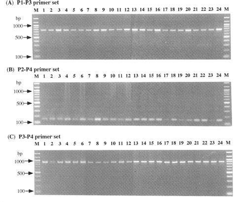 Figure 2 From Rapid Detection Of Salmonella Spp By Pcr Amplification