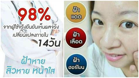 ครีมยาหมอ รักษาสิว ฝ้า หน้าขาวใสใน7วัน ดีงามสุด ยับยั้งการสร้างเม็ดสีเมลานิน เน้นปรับสภาพหน้า