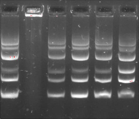 241 Questions With Answers In Plasmid Extraction Scientific Method