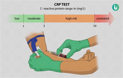 crp c reactive protein test procedure purpose results normal
