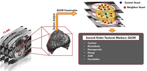 Second Order Glrlm Textural Features Extraction Where The Central Download Scientific Diagram