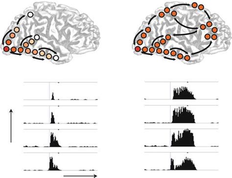 The Global Neuronal Workspace Model Of Conscious Access From Neuronal Architectures To Clinical