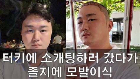 터키 소개팅하러 갔다가 졸지에 모발이식만 하고온 남자 YouTube