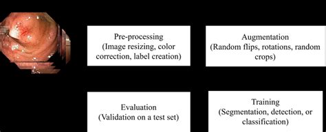 The Standard Steps Required To Build Automatic Polyp Detection Models