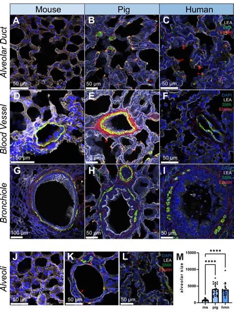 Automated Vibratome Sectioning Of Agarose Embedded Lung Tissue For