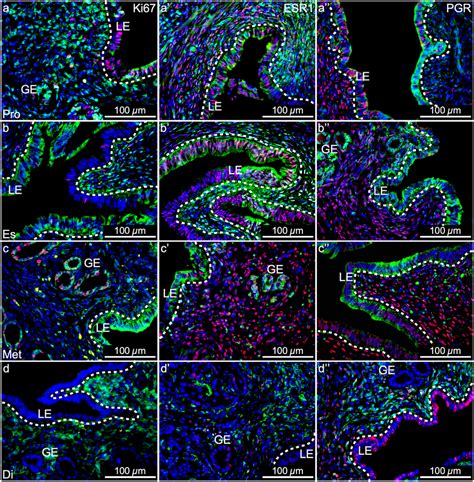 Mesenchymal Derived Md Epithelial Cells In Adult Uteri Show