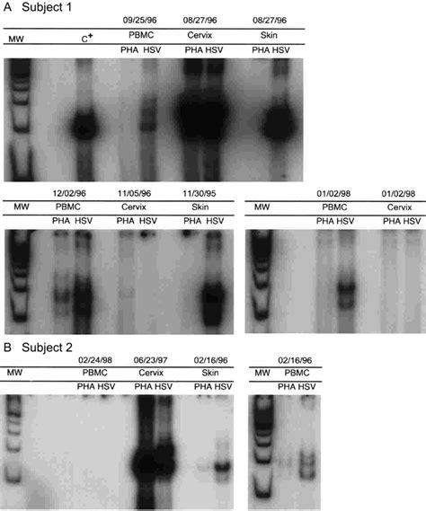 Tissue Distribution And Temporal Persistence Of Cervix Derived Herpes Download Scientific