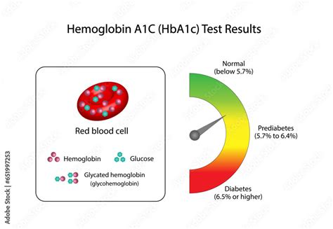 Hemoglobin A1c Hba1c Test Hba1c Levels Glucose Sticks To Hemoglobin Glycated Hemoglobin Up