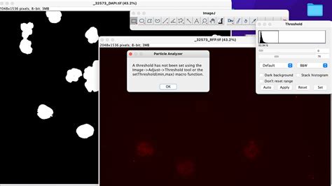 analyze particles threshold has not been set error image analysis