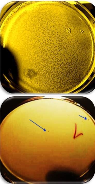 A Titer Of Recombinant Nano Phages In The First Dilution From Serial