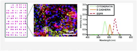High Throughput Quantification Of Protein Expression Of Cancer Antigens