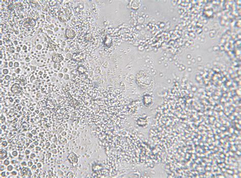 195 Questions With Answers In Pbmc Isolation Science Topic