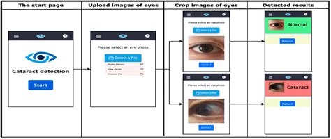 Electronics Free Full Text The Use Of Convolutional Neural Networks And Digital Camera
