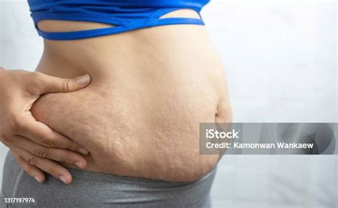 뚱뚱한 여자는 체중 통제를 필요로 하고 그녀는 과잉 지방이 있습니다 30 34세에 대한 스톡 사진 및 기타 이미지 30 34세 개념 걱정하는 Istock