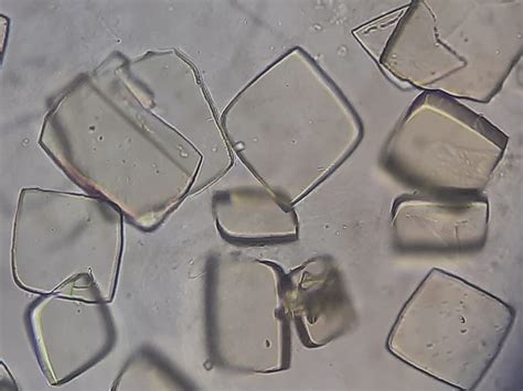 Amorphous Urates Present In Urine Means Archives Medical Notes