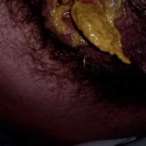 Shitty Asshole Poops 日本語で